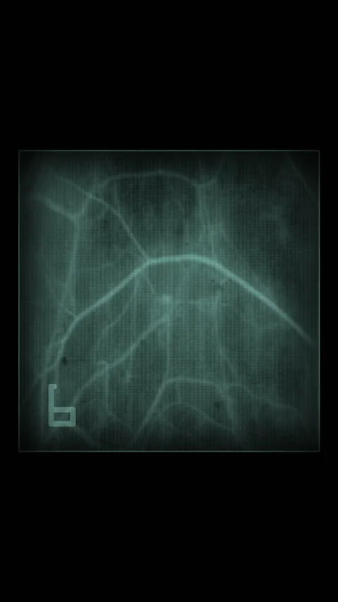 vertical video animation - x-ray panels ... | Stock Video | Pond5