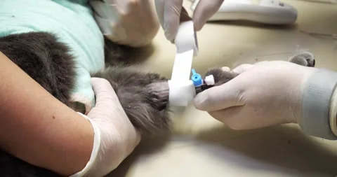 Intravenous Catheter Stock Video Footage | Royalty Free Intravenous ...