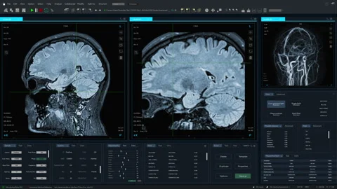 VFX Medical MRI Software Interface With ... | Stock Video | Pond5