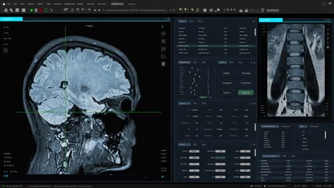 VFX Medical MRI Software Interface With ... | Stock Video | Pond5