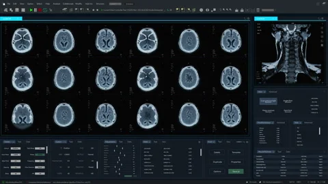 VFX Medical Xray Software Interface With... | Stock Video | Pond5