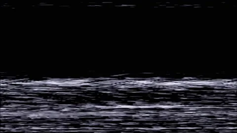 VHS Glitch, Horizontal Streaks Noise Ove... | Stock Video | Pond5