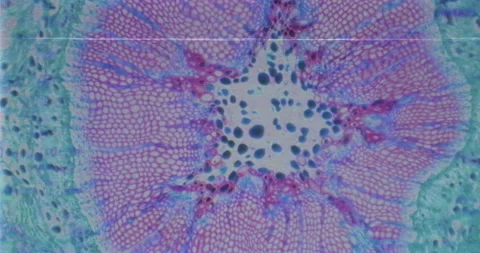 VHS recording of plant stem under a micr... | Stock Video | Pond5