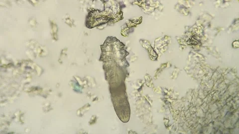 viable demodex facial mite on slide seen... | Stock Video | Pond5