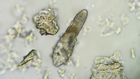 viable demodex facial mite on slide seen... | Stock Video | Pond5