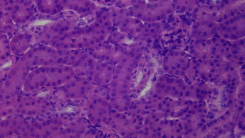 Vital organ. Kidney under the microscope... | Stock Video | Pond5