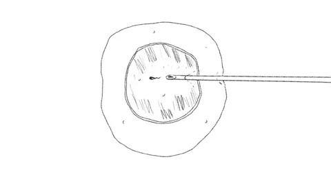 In Vitro Fertilization Process Drawing 2... | Stock Video | Pond5