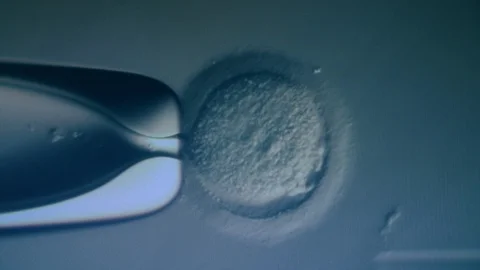 In vitro fertilization under a microscop... | Stock Video | Pond5