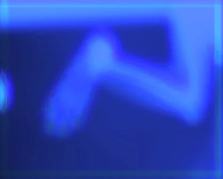 VJ Loop - X Ray sequence | Stock Video | Pond5