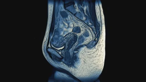 Voluminous color MRI of the female pelvi... | Stock Video | Pond5