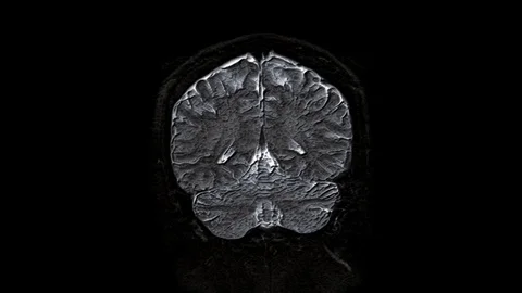 Voluminous color MRI scans of the brain ... | Stock Video | Pond5