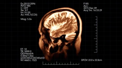 Warm color profile mri brain scan monito... | Stock Video | Pond5