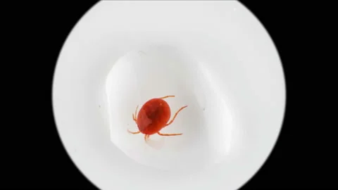 water mite-Hydrachnidia under a microsco... | Stock Video | Pond5