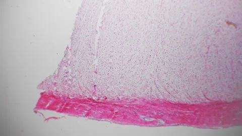 Human Tissue Stock Footage ~ Royalty Free Stock Videos | Pond5