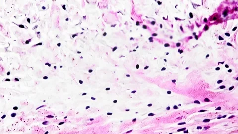 White fibrous tissue of human being film... | Stock Video | Pond5