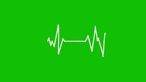 White lines animation on green screen 4k... | Stock Video | Pond5