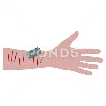 Bleeding Hand With Blade