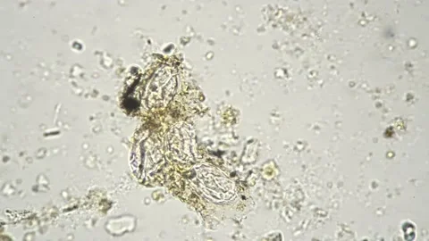 Taenia Solium Eggs Eggs Of Taenia Solium Wm Under Light Microscopy