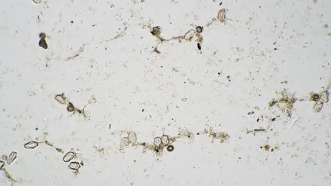 Whole mount of Taenia solium eggs under ... | Stock Video | Pond5