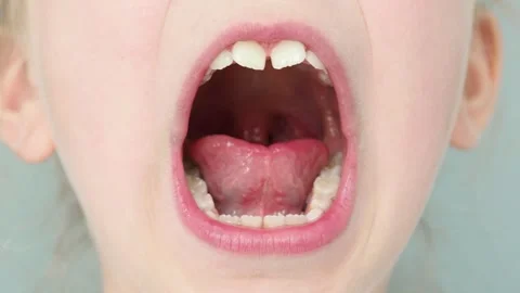 Wide open mouth with small uvula, palate... | Stock Video | Pond5