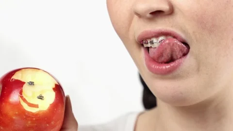 Eating With Braces Stock Videos – Royalty-Free HD & 4K Videos | Pond5