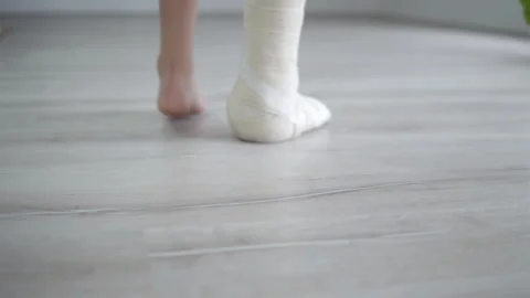 Woman with broken foot in plaster cast t... | Stock Video | Pond5