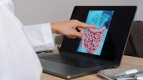 Woman Doctor showing x-ray of somach and... | Stock Video | Pond5