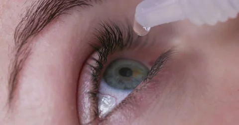 Woman dropping medical eye drops into th... | Stock Video | Pond5