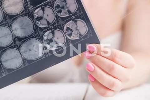 Photograph: Woman hand holding MRI brain film to see for diagnostic and ...