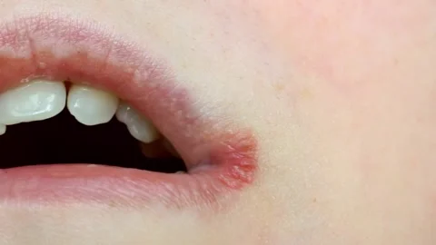 Woman hands touching a lip skin with Her... | Stock Video | Pond5