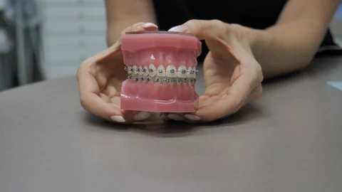 Woman showing Teeth model with braces | Stock Video | Pond5