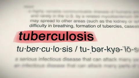 The Word tuberculosis in a Dictionary An... | Stock Video | Pond5
