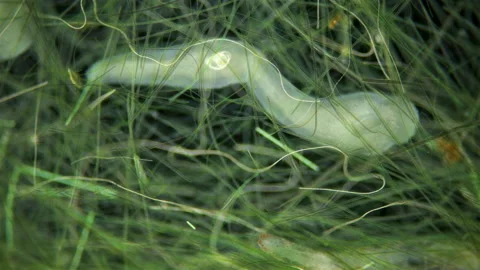 Worm Aeolosoma sp. and Microstomum linea... | Stock Video | Pond5