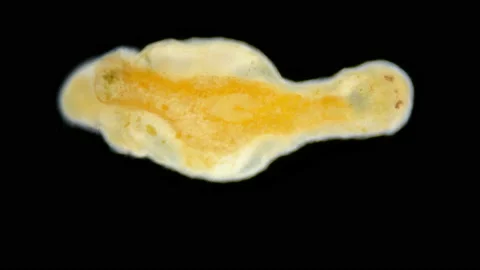 Worm Dinophilus taeniatus under a micros... | Stock Video | Pond5