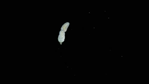 Worm family Microstomidae under microsco... | Stock Video | Pond5