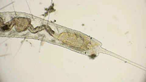 worm of the family Naididae, Pristina lo... | Stock Video | Pond5