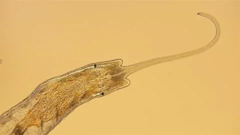 worm of the family Naididae under a micr... | Stock Video | Pond5