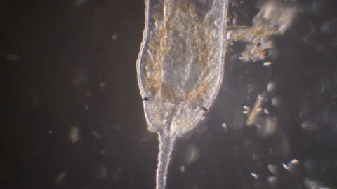 Worm of the family Naididae under the mi... | Stock Video | Pond5
