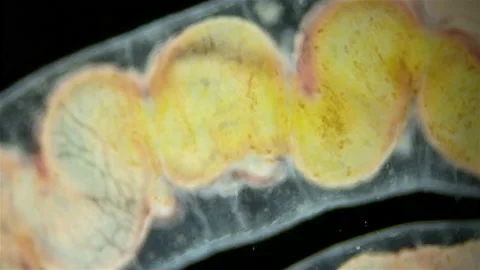 Worm from family Naididae under a micros... | Stock Video | Pond5