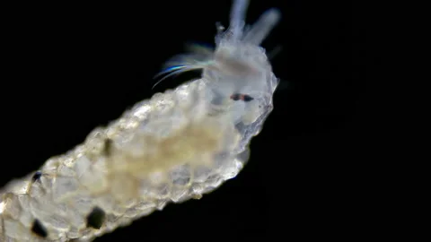 Worm family Pectinariidae under a micros... | Stock Video | Pond5