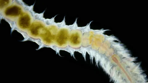 Worm family Spionidae under a microscope... | Stock Video | Pond5