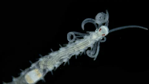 Worm family Syllidae under a microscope,... | Stock Video | Pond5