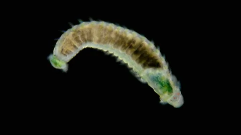 worm larva Nektoheta under a microscope,... | Stock Video | Pond5