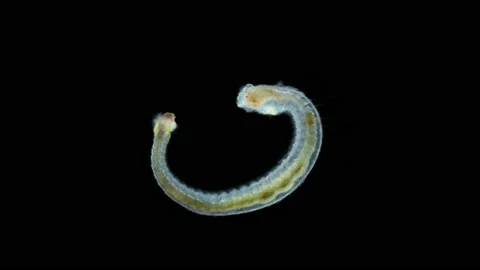 Worm larva Nektoheta under a microscope,... | Stock Video | Pond5