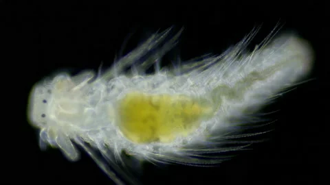 Worm larva, stage Nektoheta under a micr... | Stock Video | Pond5