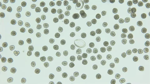 Worm larvae Ophelia limacina under micro... | Stock Video | Pond5