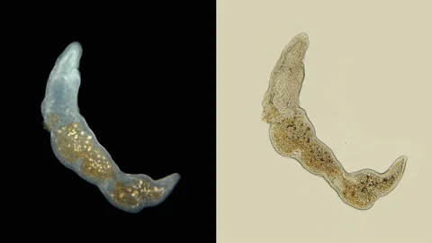 worm Microstomum sp. under the microscop... | Stock Video | Pond5