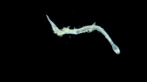 Nematoda Stock Video Footage | Royalty Free Nematoda Videos | Pond5