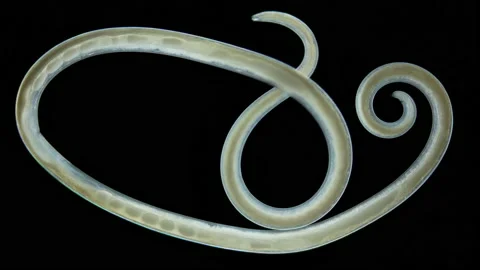 worm Nematoda under microscope, Phylum P... | Stock Video | Pond5