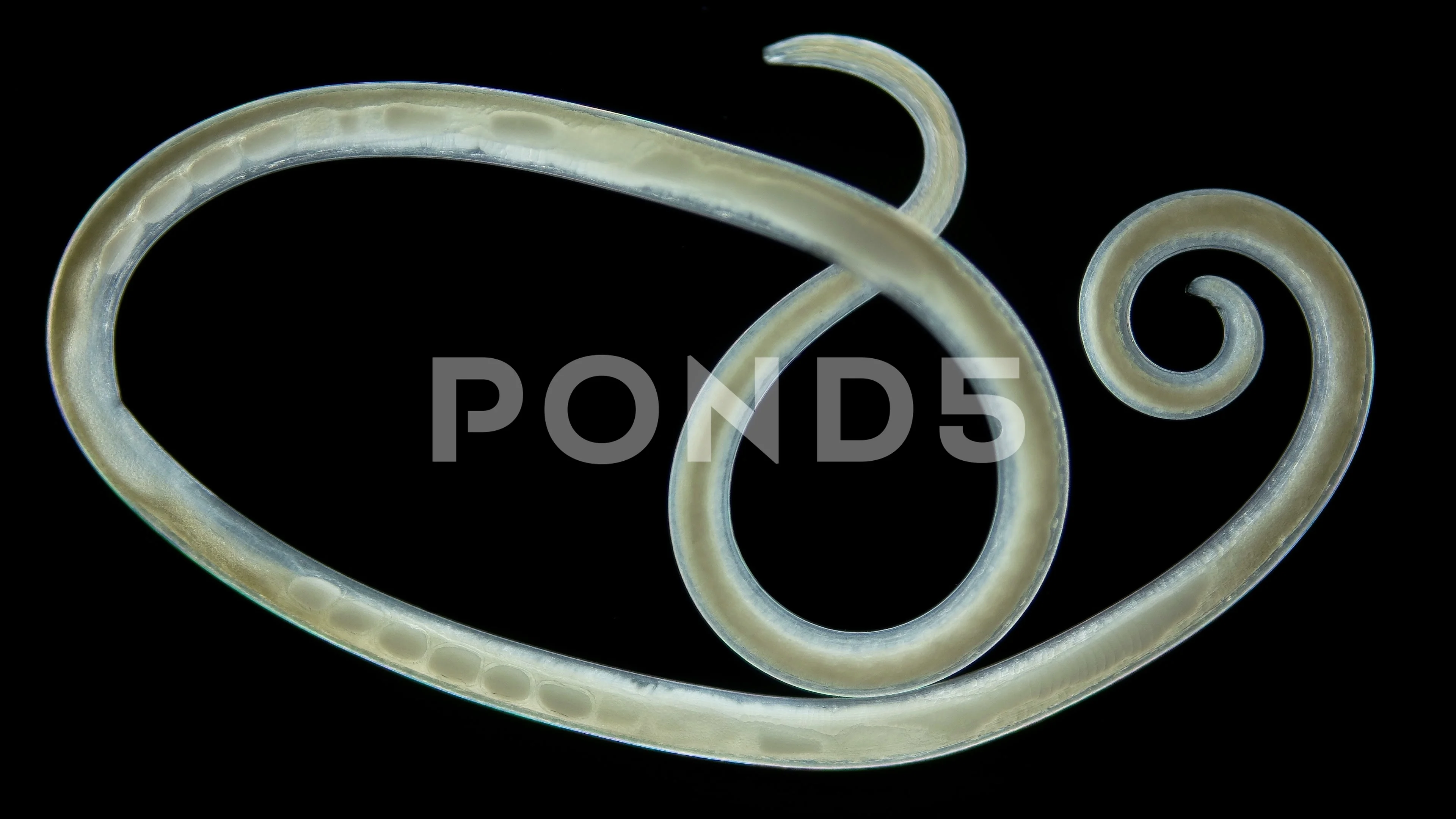 Phylum Nematoda Hookworm